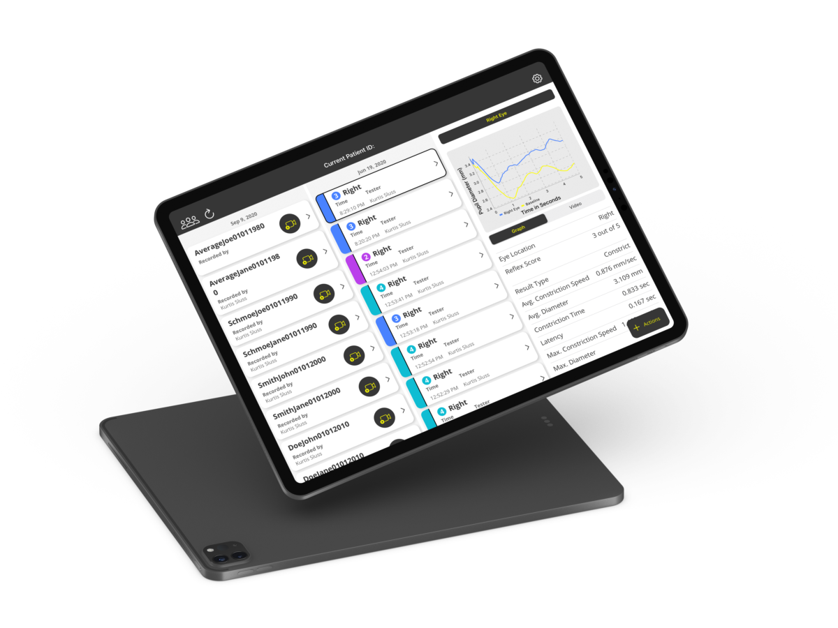 Reflex App - PLR Analyzer